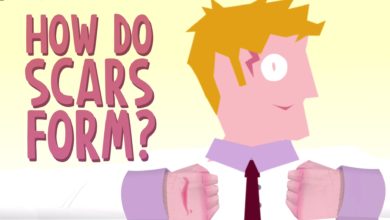 How do scars form? - Kidpid