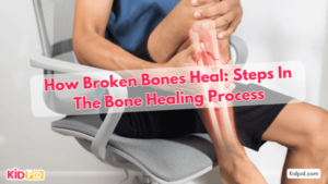 How Broken Bones Heal: Steps in the Bone Healing Process - Kidpid